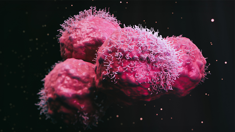 Cancer cells can drive tumour growth in breast cancer